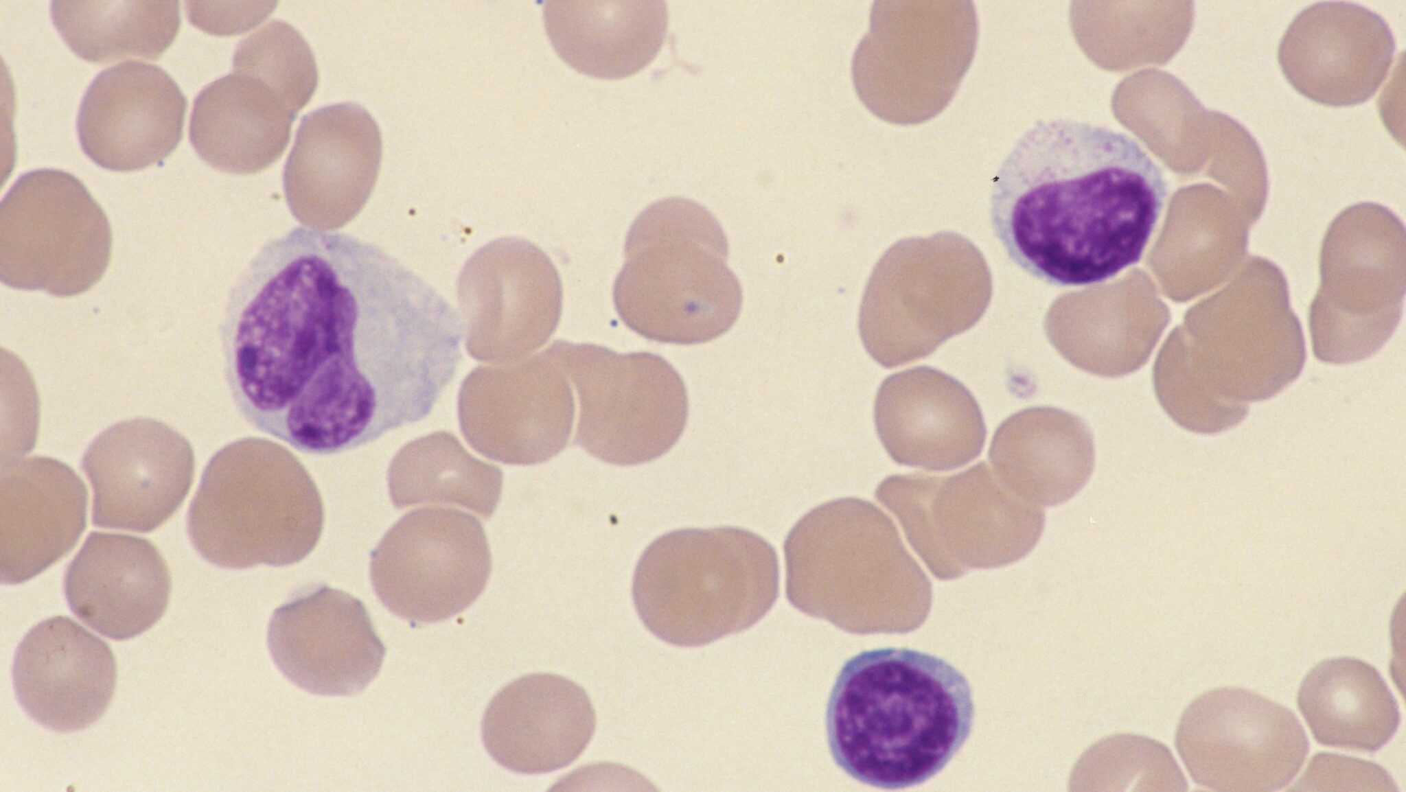 Learn more about PBMC Isolation and access 3 powerful labs