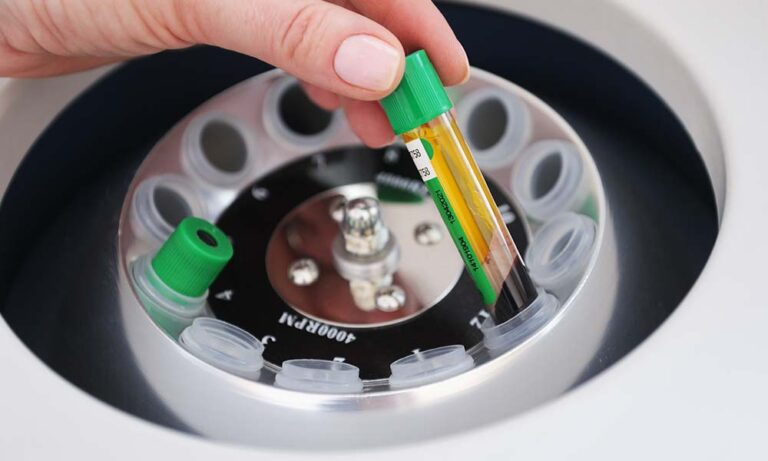 Expert PBMC Isolation - Leading Automated & Manual Services